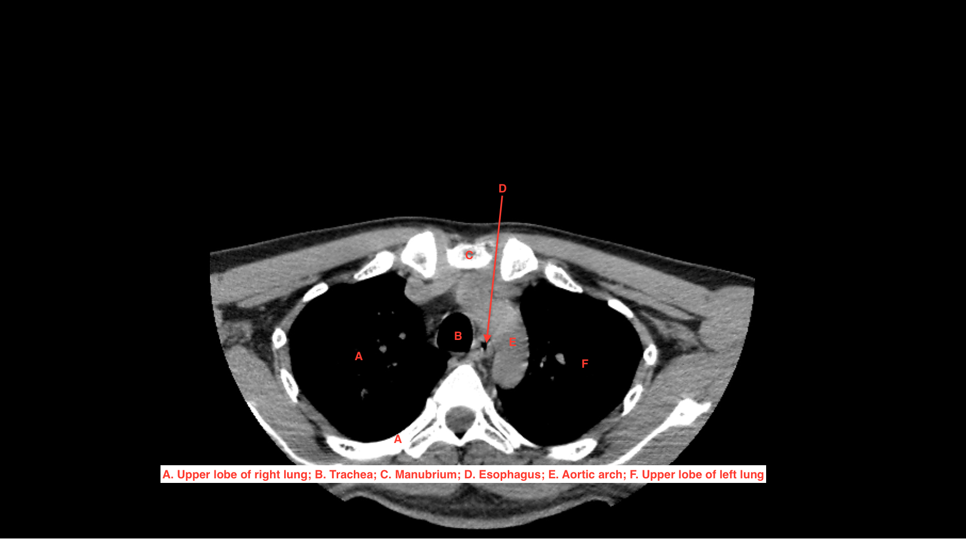 fullsizeoutput_115 – My CT Registry Review