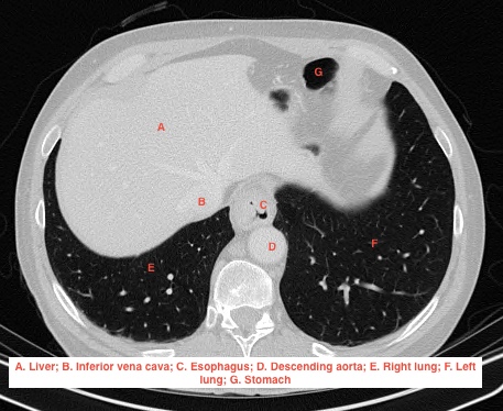 Version 2 – My CT Registry Review