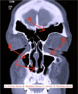 Cross Sectional Images: Head – My CT Registry Review